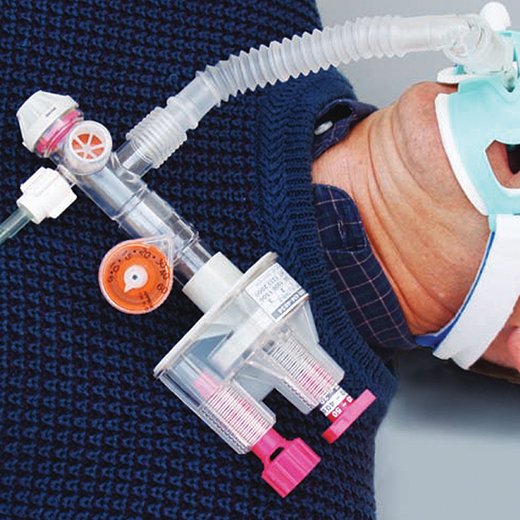 Hartwell Medical Surevent - Transport Ventilator Automatic - SV2131B ...