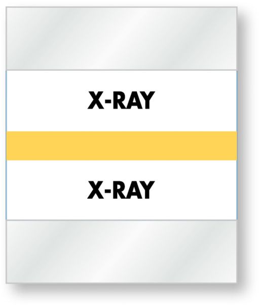 Medical Use Labels - Color-Coded Chart Divider Tabs - Tan - "X-Ray", 1 ...